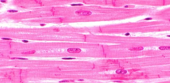 Cardiac Muscle Tissue Identification Quiz - Quiz, Flashcards & Trivia